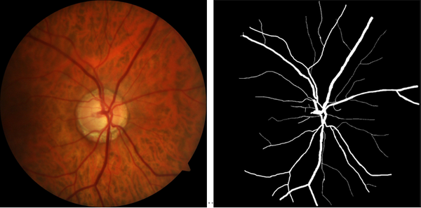 ORVS 数据集介绍 - 知乎