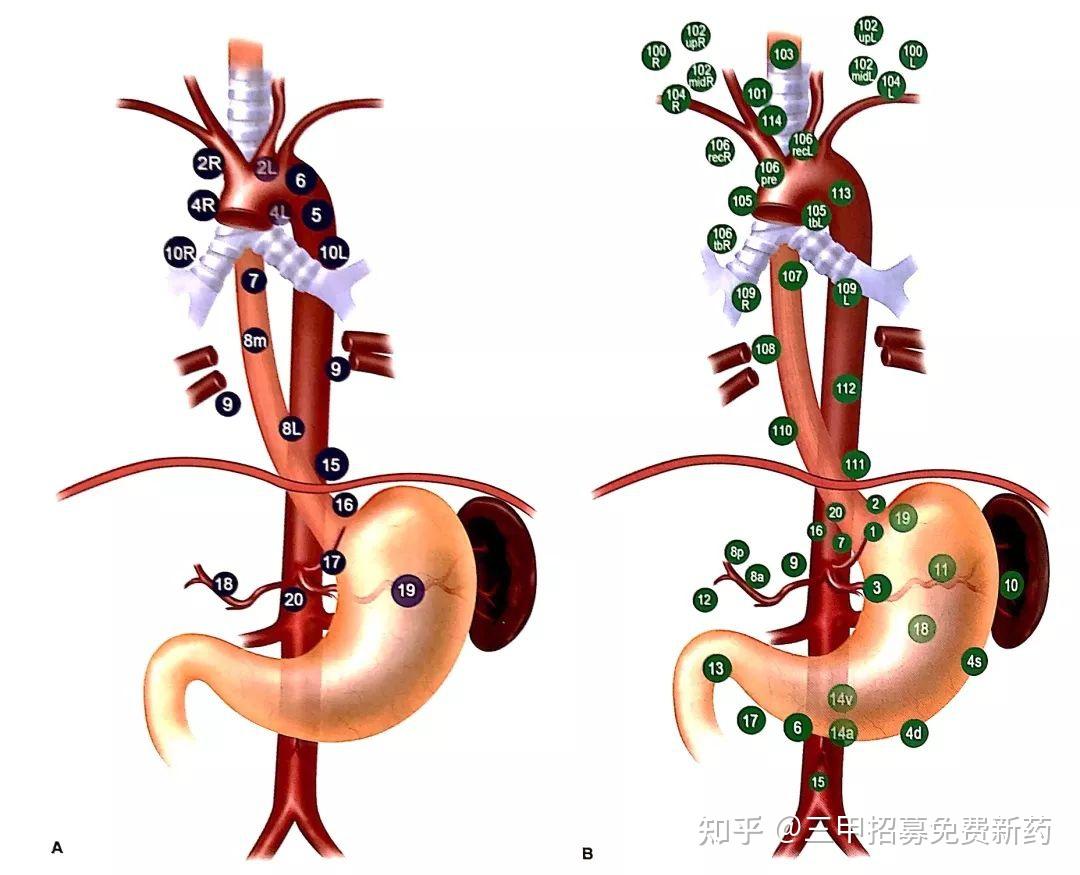 食管癌 TNM 分期，对治疗非常重要，您了解多少？ - 知乎