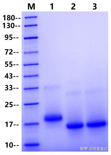 上新！蛋白快速去糖基化酶：Fast PNGase F Kit - 知乎