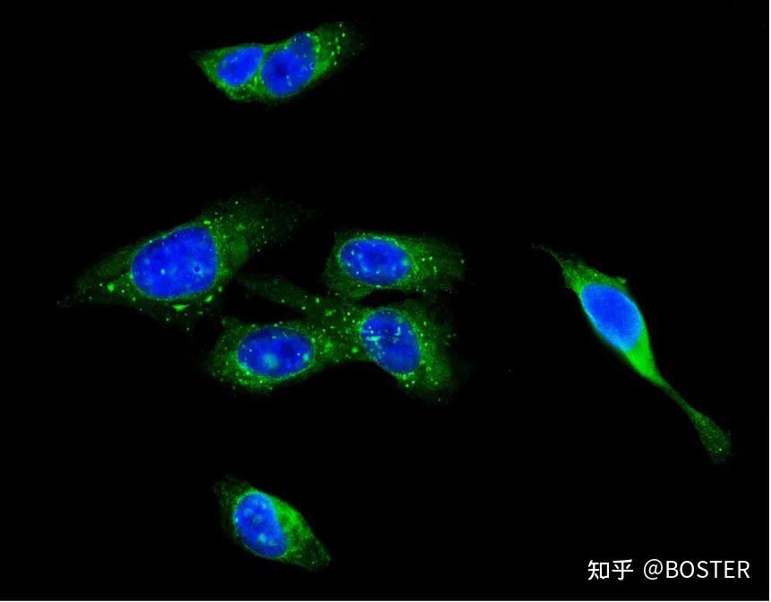 细胞器标记物蛋白的免疫组化/荧光 - 知乎