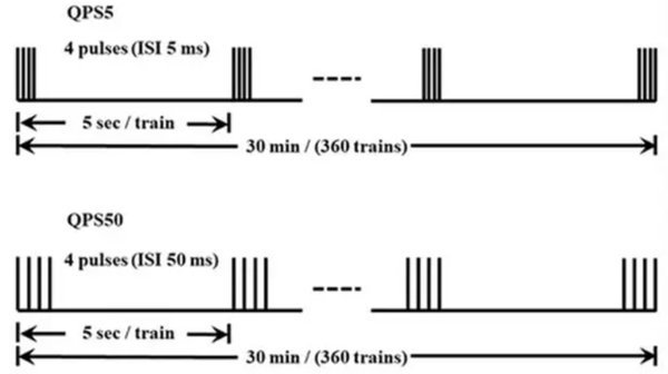 TMS安全指南权威解读（一）：应用新开发的刺激设备和脉冲配置的安全性问题 - 知乎