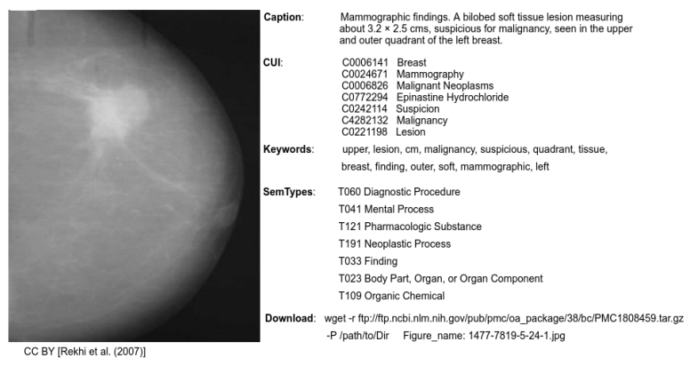 ROCOV2 数据集介绍 - 知乎