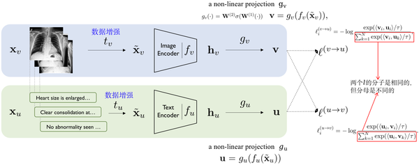 [论文笔记]ConVIRT: Contrastive Learning of Medical Visual Representations ...