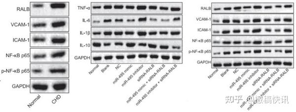 WB图可疑，流式图似手绘，中国医科大学附属第一医院的论文被撤稿 - 知乎