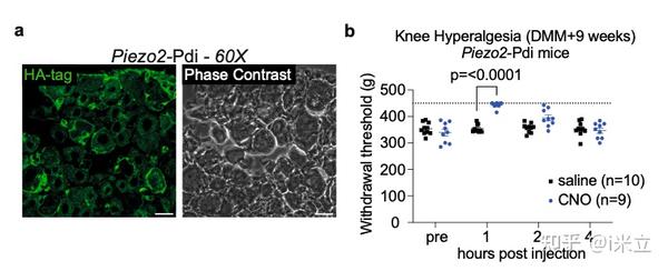 IF:17.694|Piezo2：一个治疗骨关节炎疼痛的新靶点 - 知乎