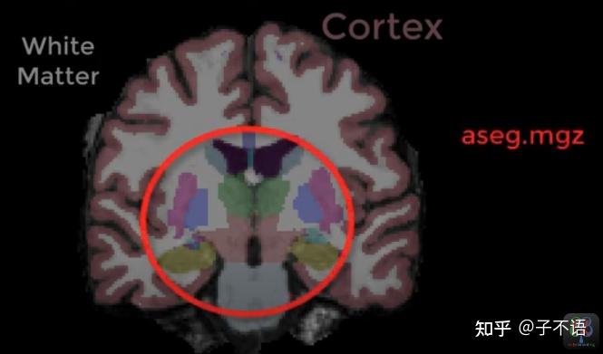 freesurfer全过程梳理 - 知乎