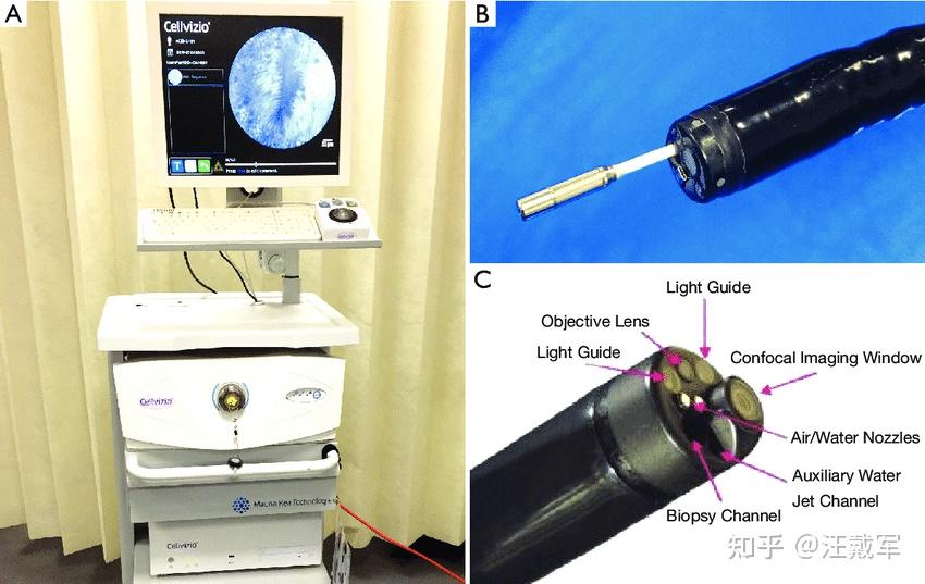 术中实时共聚焦显微镜，单中心50例脑肿瘤切除手术应用经验 - 知乎
