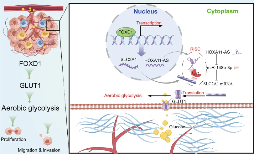 FOXD1通过调节GLUT1介导的有氧糖酵解促进胰腺癌细胞增殖、侵袭和转移 - 知乎