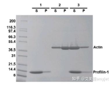 Cytoskeleton——Profilin 1蛋白：未标记的人重组蛋白 - 知乎
