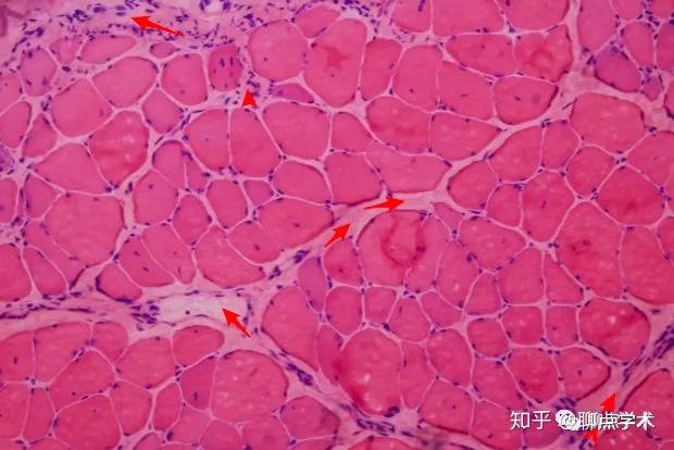 首创！IPP（Image-Pro Plus）精准测量肌纤维直径的方法讲解 - 知乎