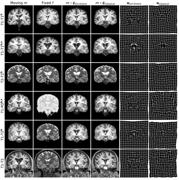 分割图——SynthMorph，零样本学习完成跨模态配准任务 - 知乎
