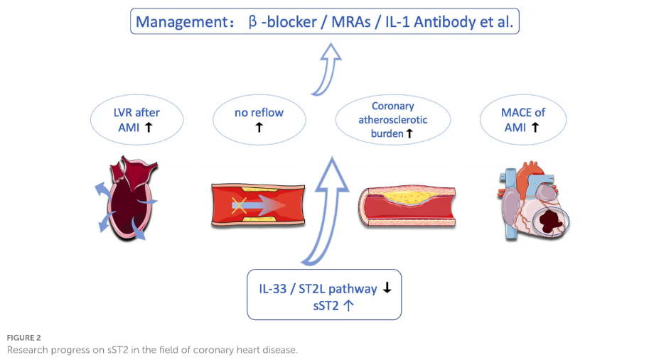 领异标心 | ST2作为冠状动脉疾病生物标志物的临床应用 - 知乎