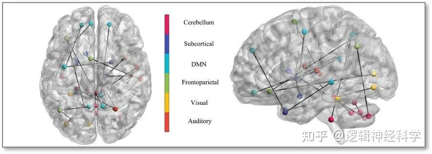 Transl Psychiatry︱西南大学贾韬授团队发现重度抑郁患者的大脑功能存在加速老化：来自大规模中国参与者的证据 - 知乎