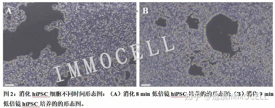 hiPSC人诱导多能干细胞培养教程 - 知乎