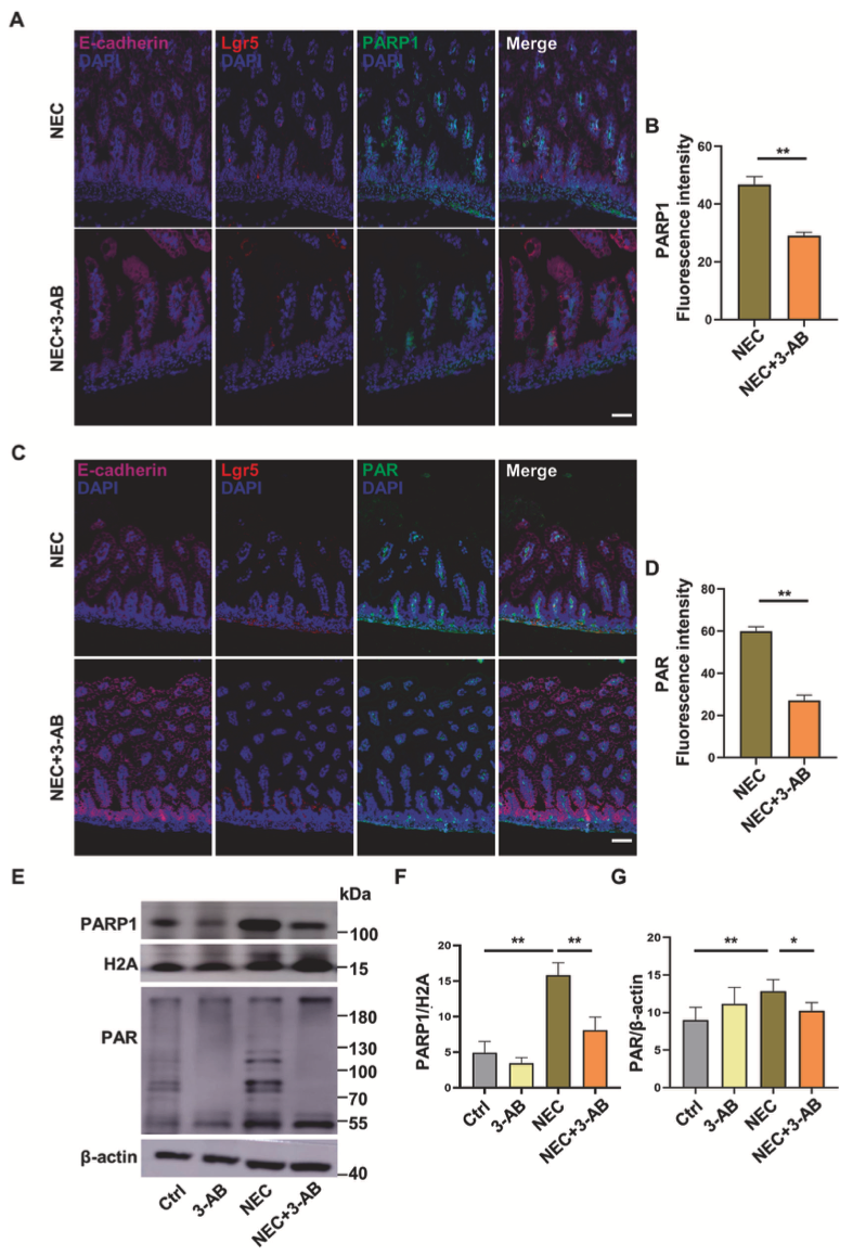 CDD丨ROS 诱导的 DNA 损伤引发的 parthanatos 参与了坏死性小肠结肠炎期间的肠上皮损伤 - 知乎