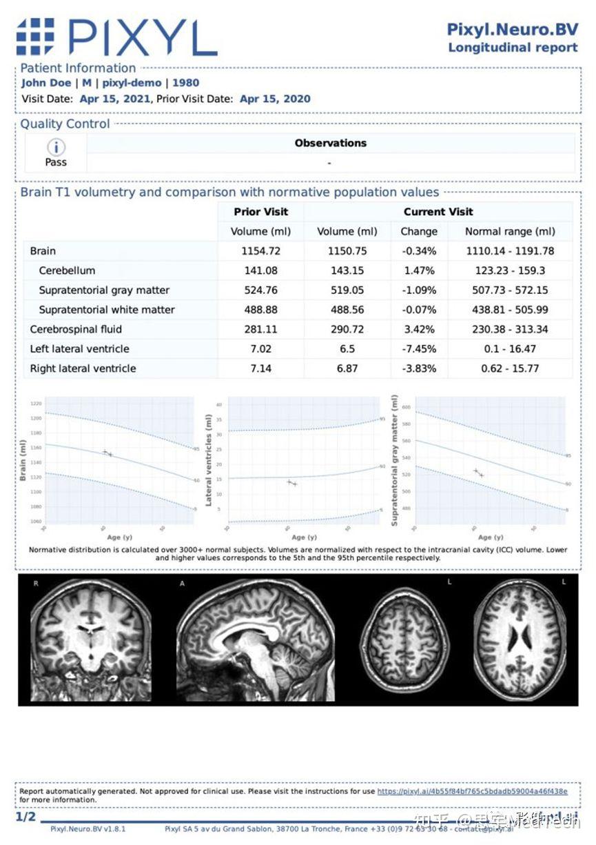 Pixyl：头部MRI分析AI软件获批FDA！ - 知乎