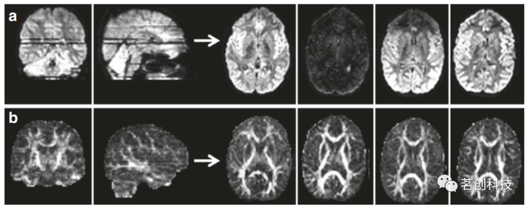 BOLD fMRI和DTI：伪影、技巧和诀窍 - 知乎
