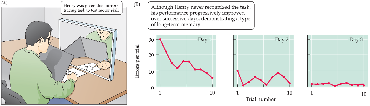 脑科学史话丨“记不住”的亨利·莫莱森，“被记住”的H.M.病人 - 知乎