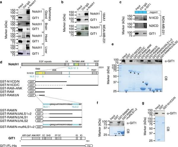 Nat Commun︱卡罗林斯卡医学院发现GIT1抑制乳腺癌生长并可评估患者预后风险 - 知乎