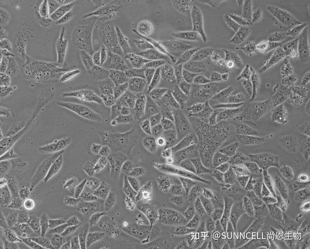 干货！！SK-LU-1（人低分化肺腺癌细胞）传代标准操作流程 - 知乎