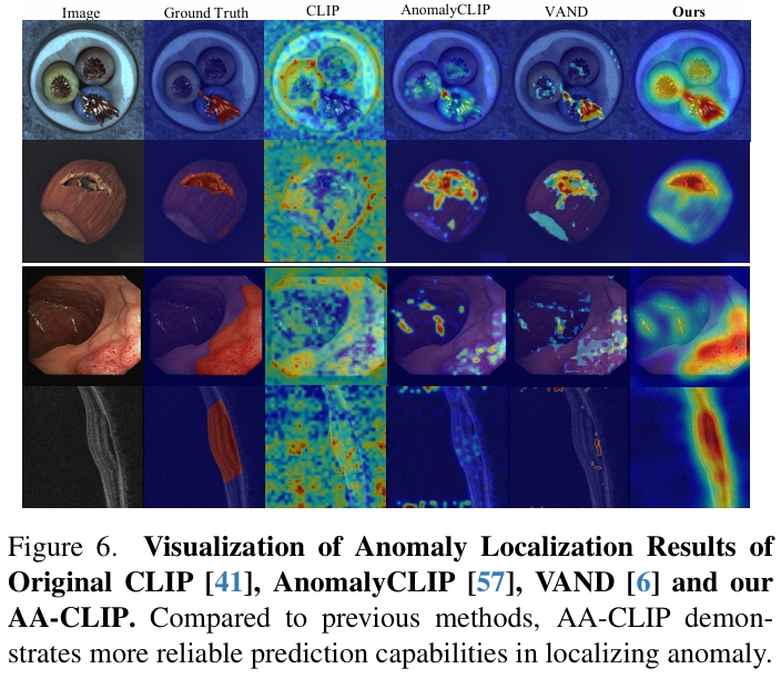 【CVPR 2025】AA-CLIP：基于异常感知CLIP的零样本异常检测增强方法（AA-CLIP） - 知乎