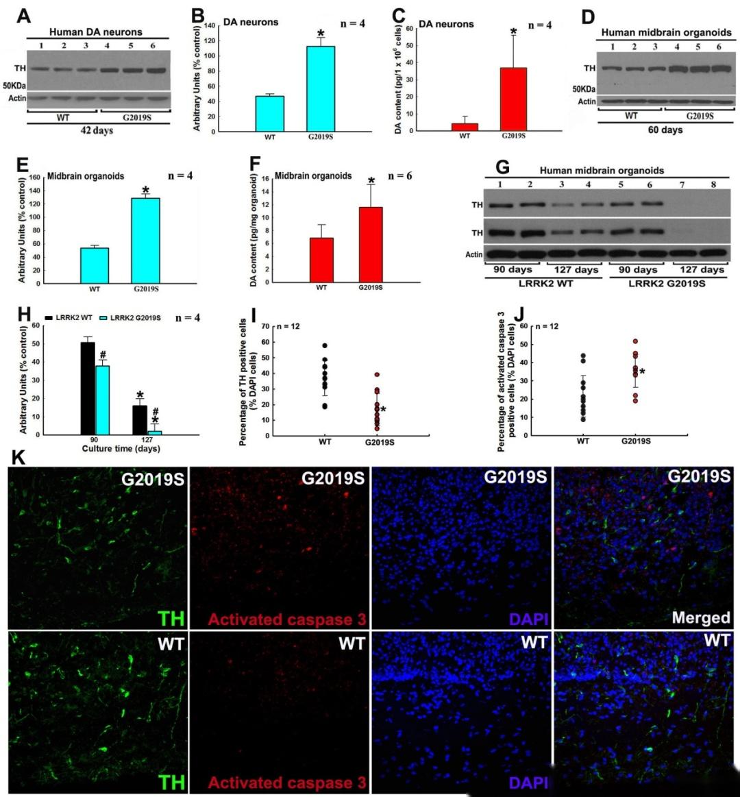 CMLS︱周志东团队揭秘酪氨酸羟化酶-多巴胺通路在帕金森病中的病理机制 - 知乎