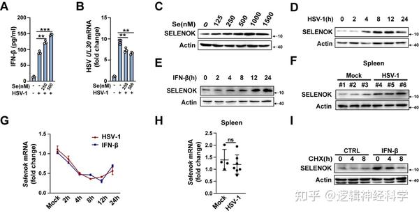 PLoS Pathog︱山东大学贾木天/赵伟团队揭示硒蛋白调控STING激活新机制 - 知乎