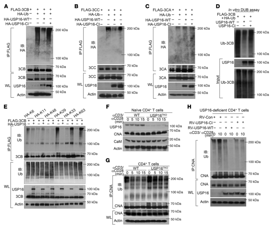 USP16介导的钙调磷酸酶A去泛素化控制外周 T细胞稳态维持 - 知乎