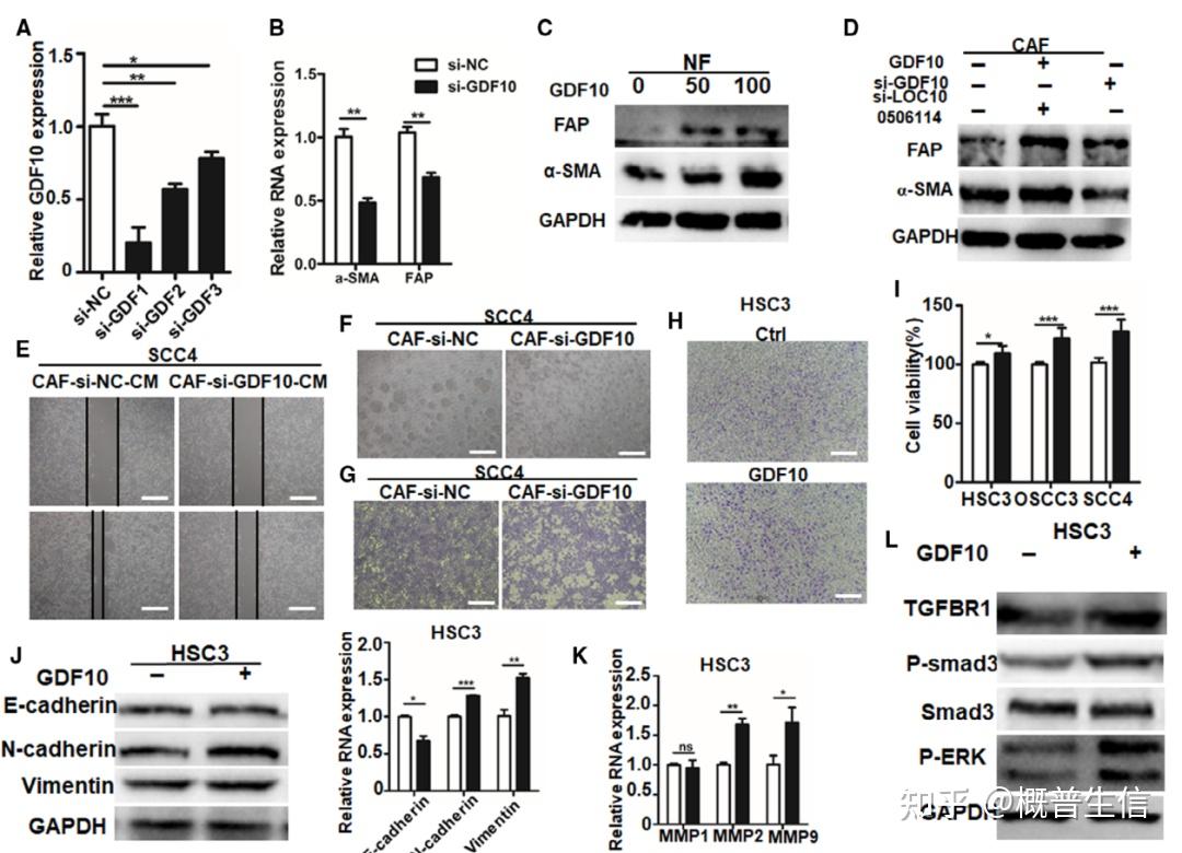 2022年最新肿瘤相关成纤维细胞(CAFs)生信思路多角度总结 - 知乎