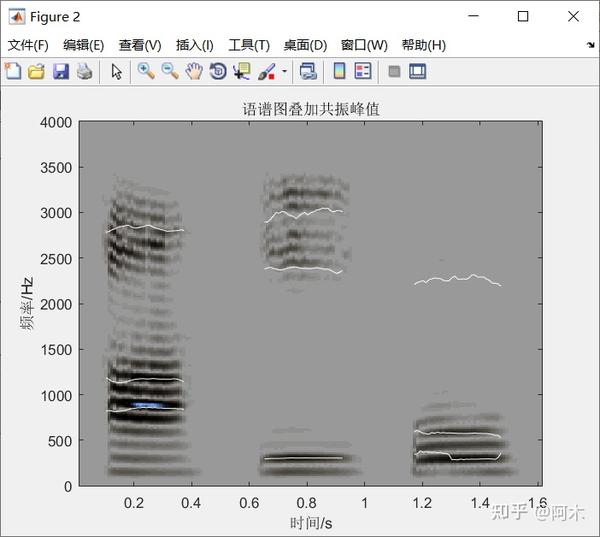 语音识别 09 共振峰的估算方法 知乎 