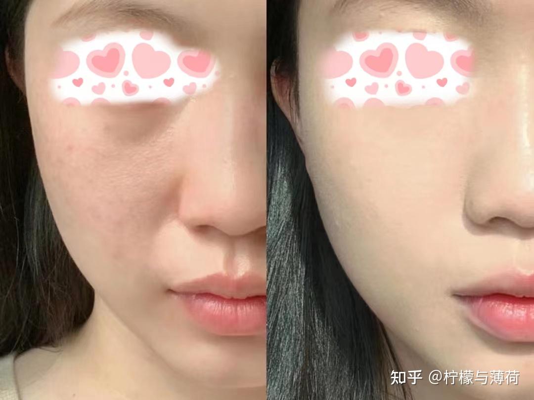 GEMO金茉美容仪好用吗？哪款最值得入手？内附GEMO金茉美容仪G20使用分享，买前必看！