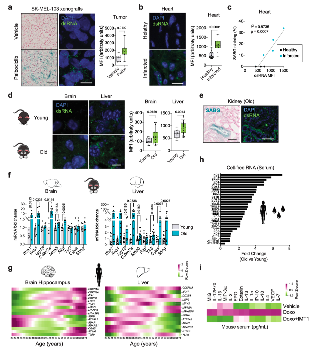 Nature子刊丨线粒体 dsRNA 释放到细胞质是衰老细胞炎症表型的关键驱动因素 - 知乎