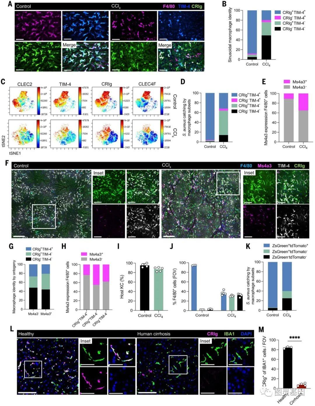 Science ｜ 肝脏的自救：Kuffer合胞体在纤维化肝脏中补充巨噬细胞功能 - 知乎