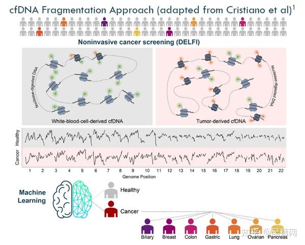 敏感性90%！片段组学分析技术登上Nature子刊，DELFI/LDCT联合方法精准识别肺癌 - 知乎