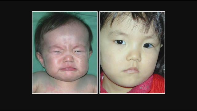 Rox Anderson：从激光医学之父到最成功的医生创业者 - 知乎