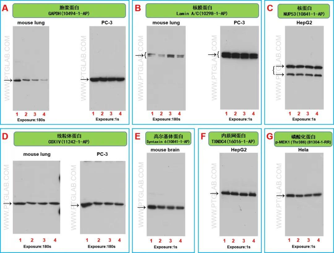 【整理】WB样本制备，这些关键点需要注意 - 知乎