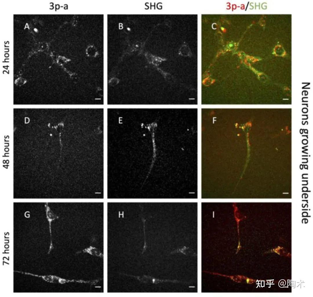 TargetMol 明星分子——Forskolin - 知乎
