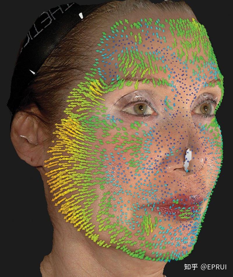 25-45um 医美用CaHA羟基磷灰石微球 - 知乎