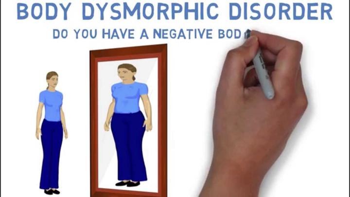 躯体变形障碍（body dysmorphic disorder，BDD）的常见线索 - 知乎