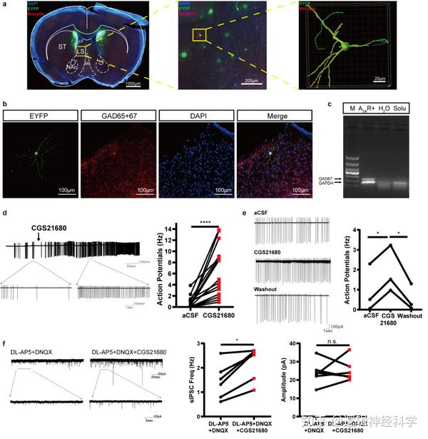 Nat Commun︱温州医科大学陈江帆/郭卫团队揭示外侧隔区腺苷A2A受体调控抑郁样行为的神经环路机制 - 知乎