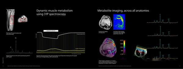 最新！飞利浦磁共振成像系统MR 7700获FDA批准 - 知乎