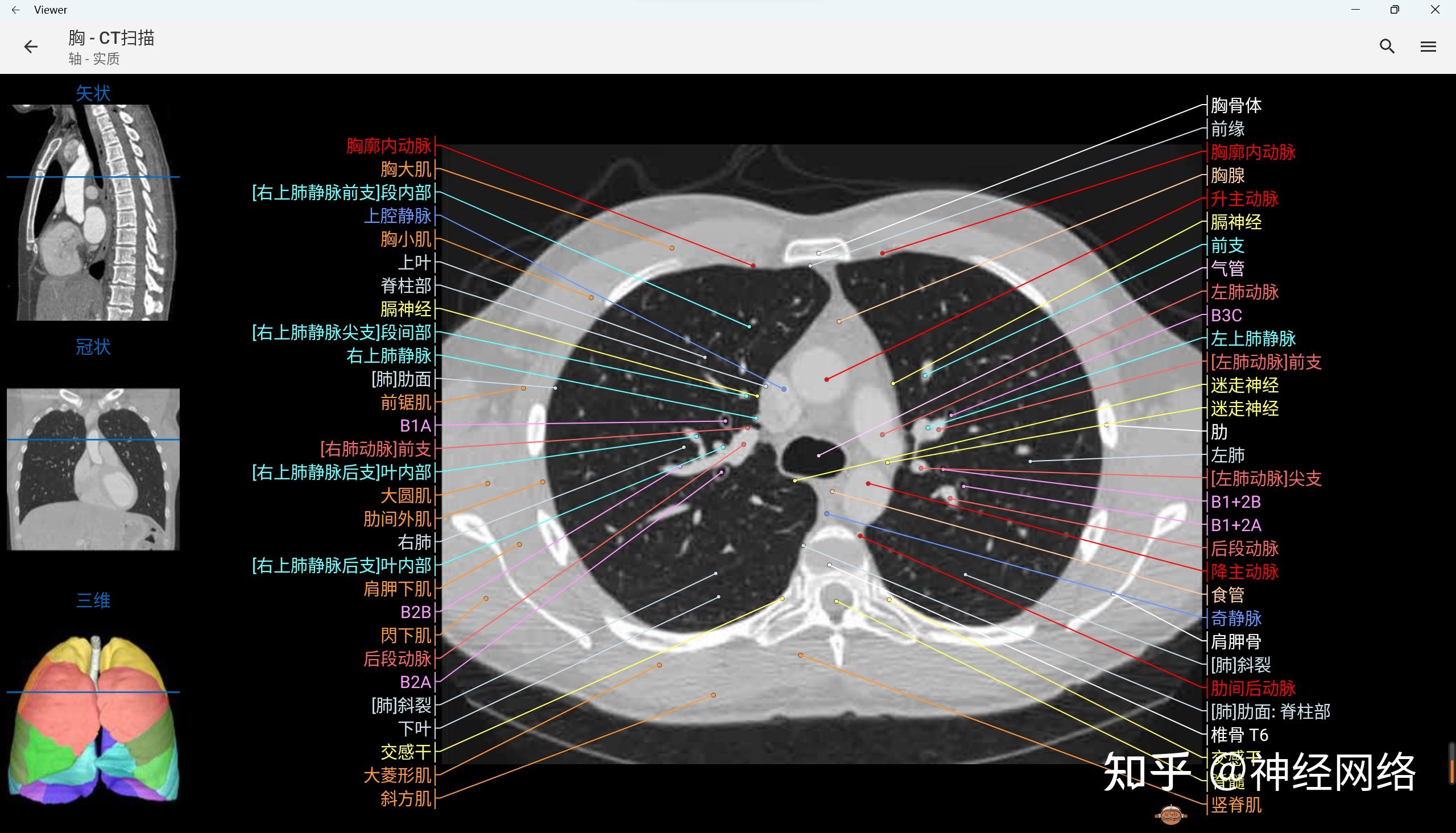 推荐一款超实用的影像软件工具 e-Anatomy（支持安卓、win11及Mac设备） - 知乎