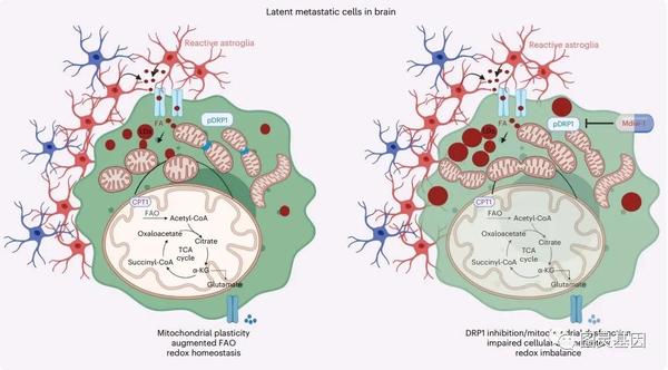 Nat Can | 线粒体脂质代谢变化可抑制乳腺癌脑转移 - 知乎