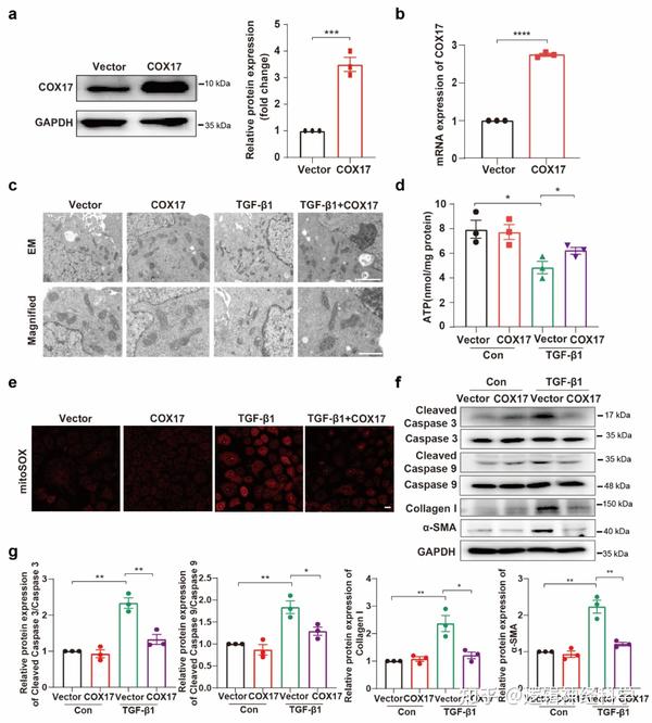 APS︱同济大学附属同济医院余晨团队揭秘线粒体内铜过载对肾脏纤维化的作用及调控机制 - 知乎