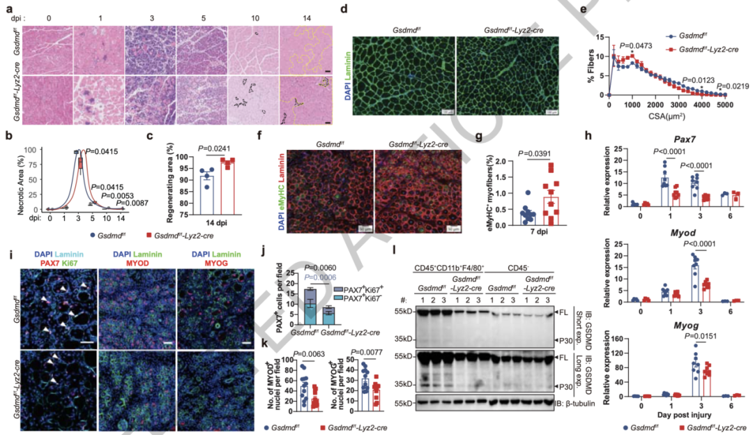 Nature丨GSDMD是炎症早期组织修复所必须的——代谢重编程的突出作用 - 知乎