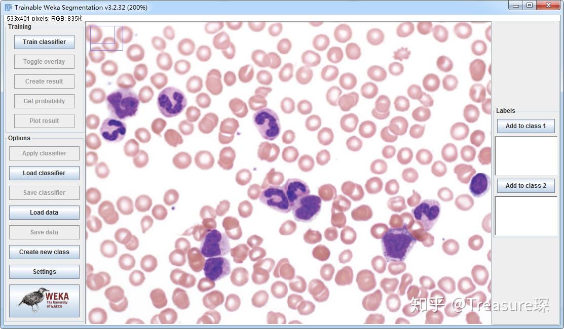 ImageJ实用技巧——基于机器学习的自动细胞分割(插件篇) - 知乎