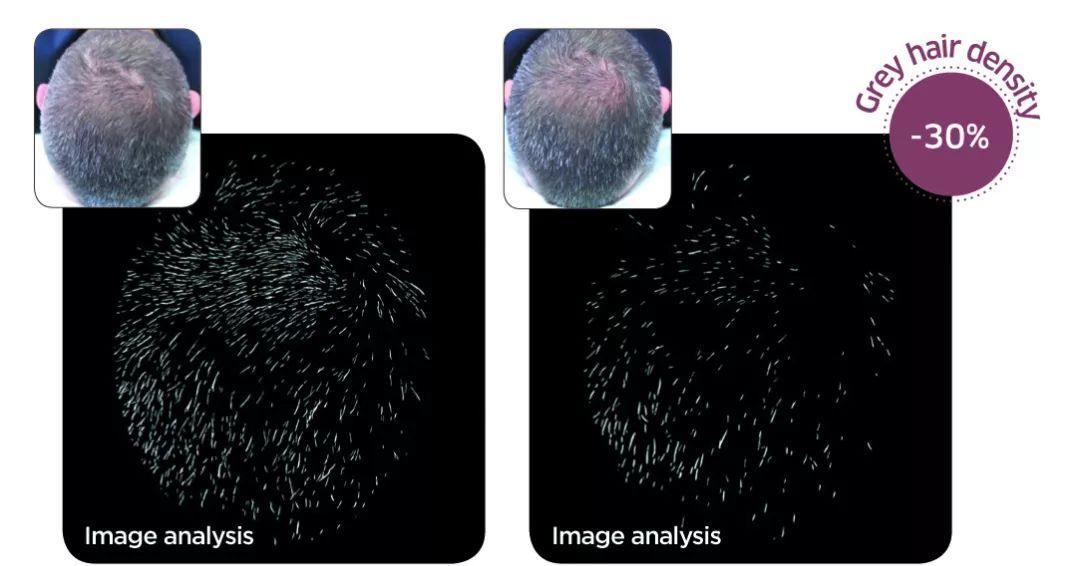 少白头？产后白发？瑞士专利非染发高科技来啦 - 知乎