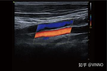 新年首发|VINNO Q系列产品大片全新登场 - 知乎