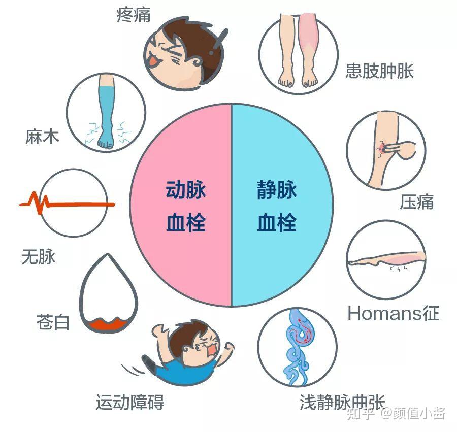 下肢静脉血栓的形成原因有哪些 - 知乎