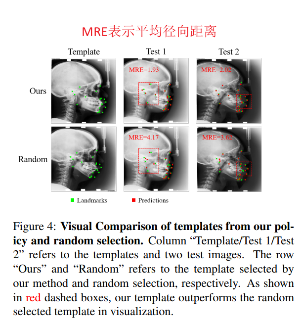【医学图像-小样本学习】Which images to label for few-shot medical landmark ...